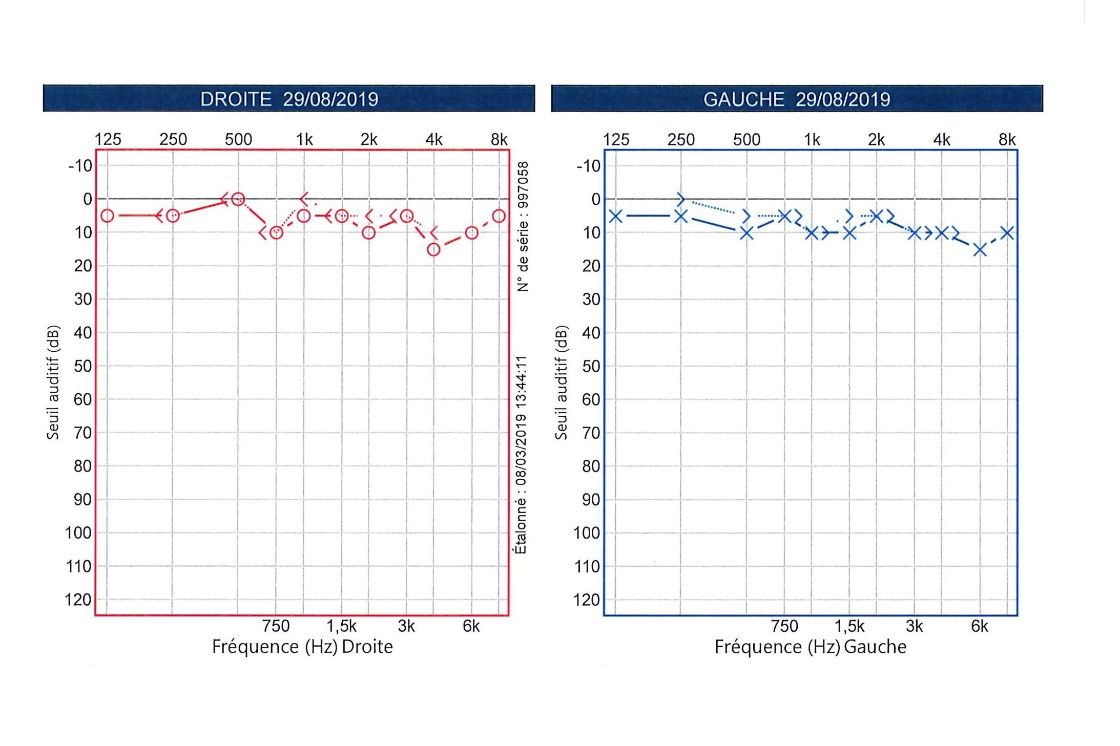 Audiogramme : lire les résultats de son bilan auditif - Amplifon