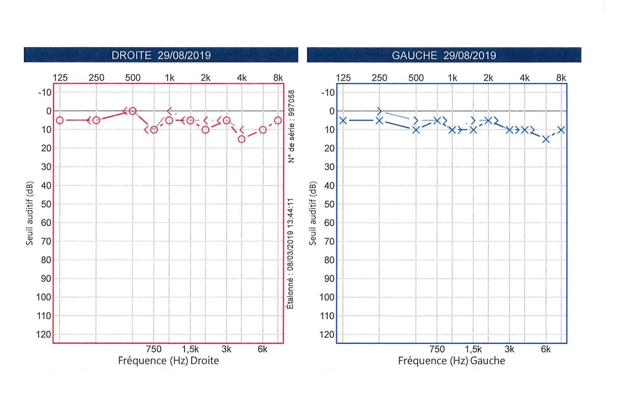 Audiogramme : lire les résultats de son bilan auditif - Amplifon