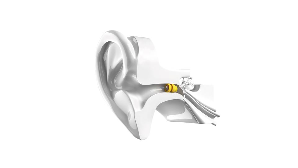 Phonak Lyric: 100% unsichtbar | Lyric Hörgeräte | Amplifon