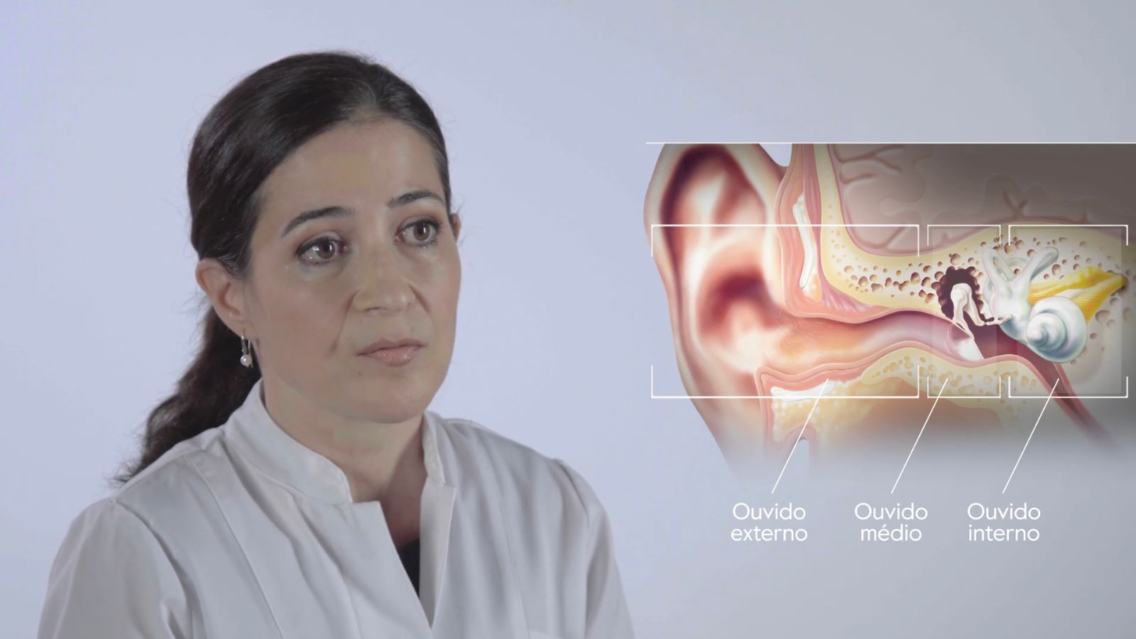 What is tympanosclerosis and how to avoid it? | Amplifon